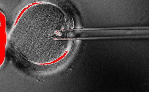 Britain will allow doctors to create babies using DNA from 3 people ...