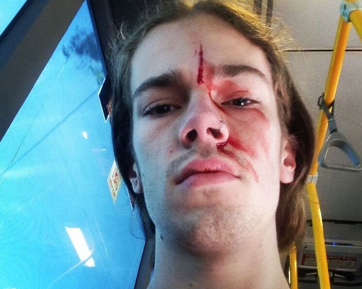 This teen was attacked when he confronted a homophobe in the street ...