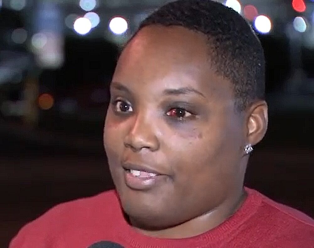 A lesbian was badly injured after 5 men brutally beat her - LGBTQ Nation