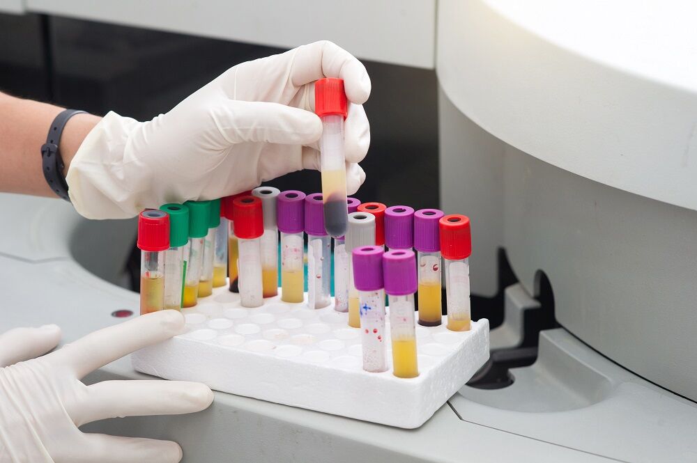 LA LGBT Center eliminates free STI screening after funding cuts - LGBTQ ...