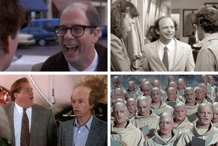 Going bald at age 19 was incredibly traumatic. But now I'm glad it ...